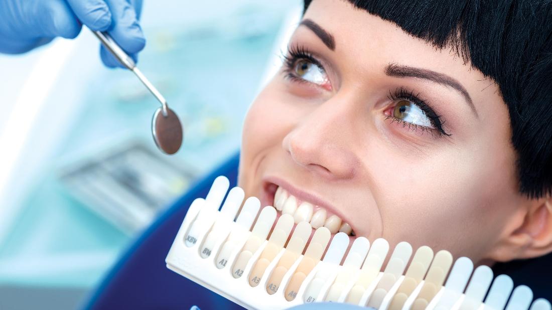 How to Fix a Discolored Tooth | Wilmington Dentist